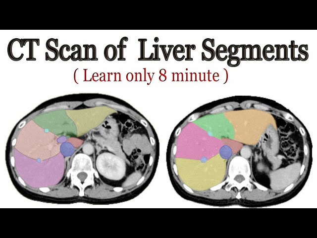 Liver Anatomy Segments