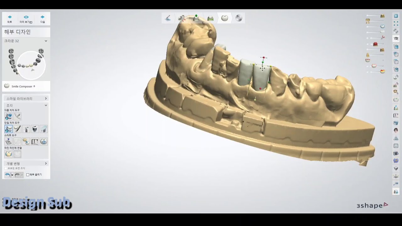 3shape design - YouTube