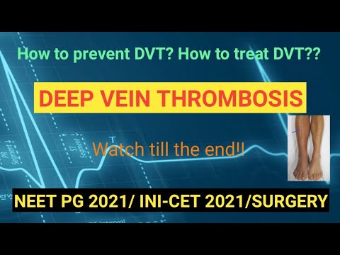 HOW TO PREVENT DVT? HOW TO TREAT DVT? DEEP VEIN THROMBOSIS | GENERAL ...
