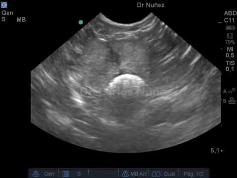 Normal Prostate Gland Adult Canine VIDEO Dr Nunez