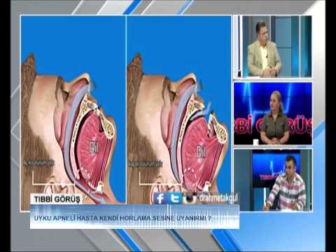 Uyku apneli hasta kendi horlama sesine uyanır mı?