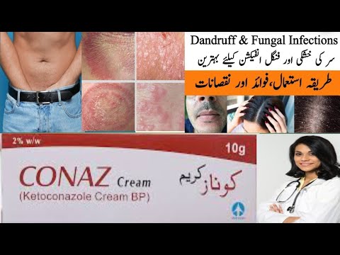 conaz cream uses in Urdu | conaz lation | conaz lation shampoo benefits ...