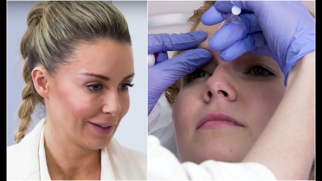 Zobacz jak wyglądają zastrzyki z botoksu na migrenę [W dobrym stylu ...