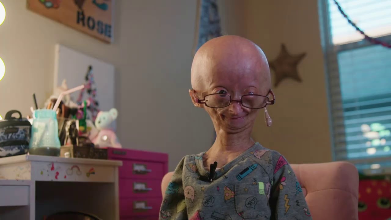 The girl who ages too fast - YouTube