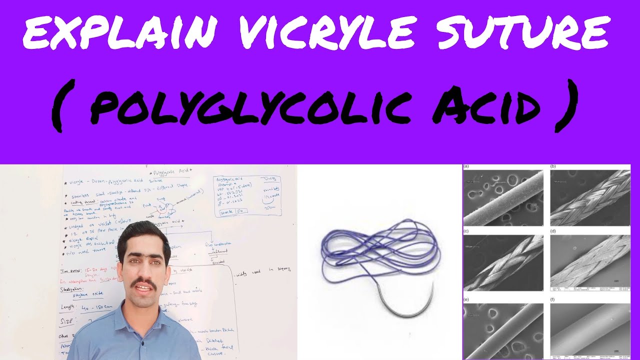 Fully Explain vicryle suture|Polyglycolic Acid |Types of vicryle|Uses ...