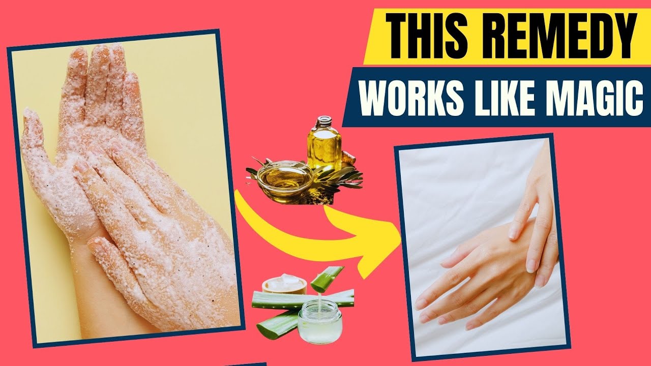 How to Soften Rough Hands Using Natural Ingredients - YouTube