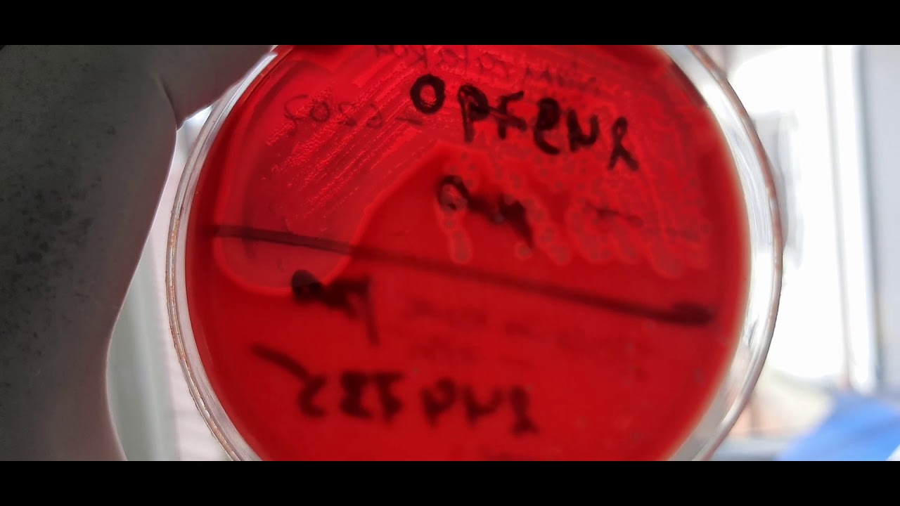 Staphylococcus aureus , E coli and Klebsiella penumoniae on growth on ...