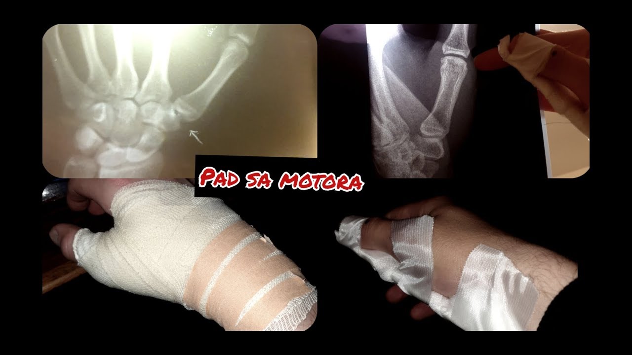 Pad sa motora (LECIO SAM SE KOD VETERINARA) CBR 125R - YouTube