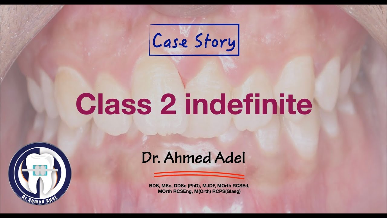 Class 2 Division 2 (Indefinite) case step from initial visit till final ...