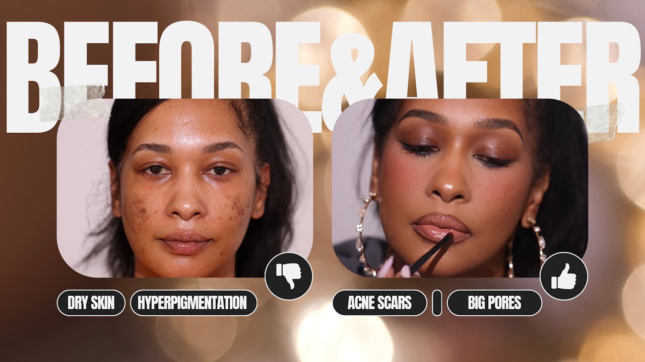 FULL COVERAGE GLAM on acne scars and dark spots. Makeup transformation ...