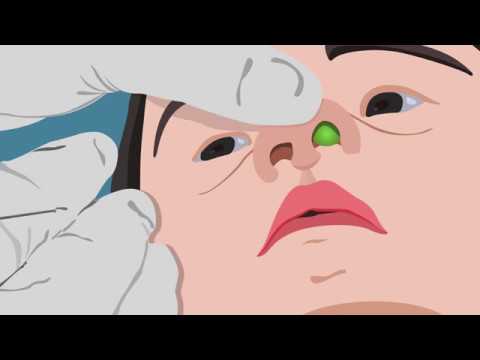 Noxeno- Nasal Foreign Body Removal Animation - YouTube