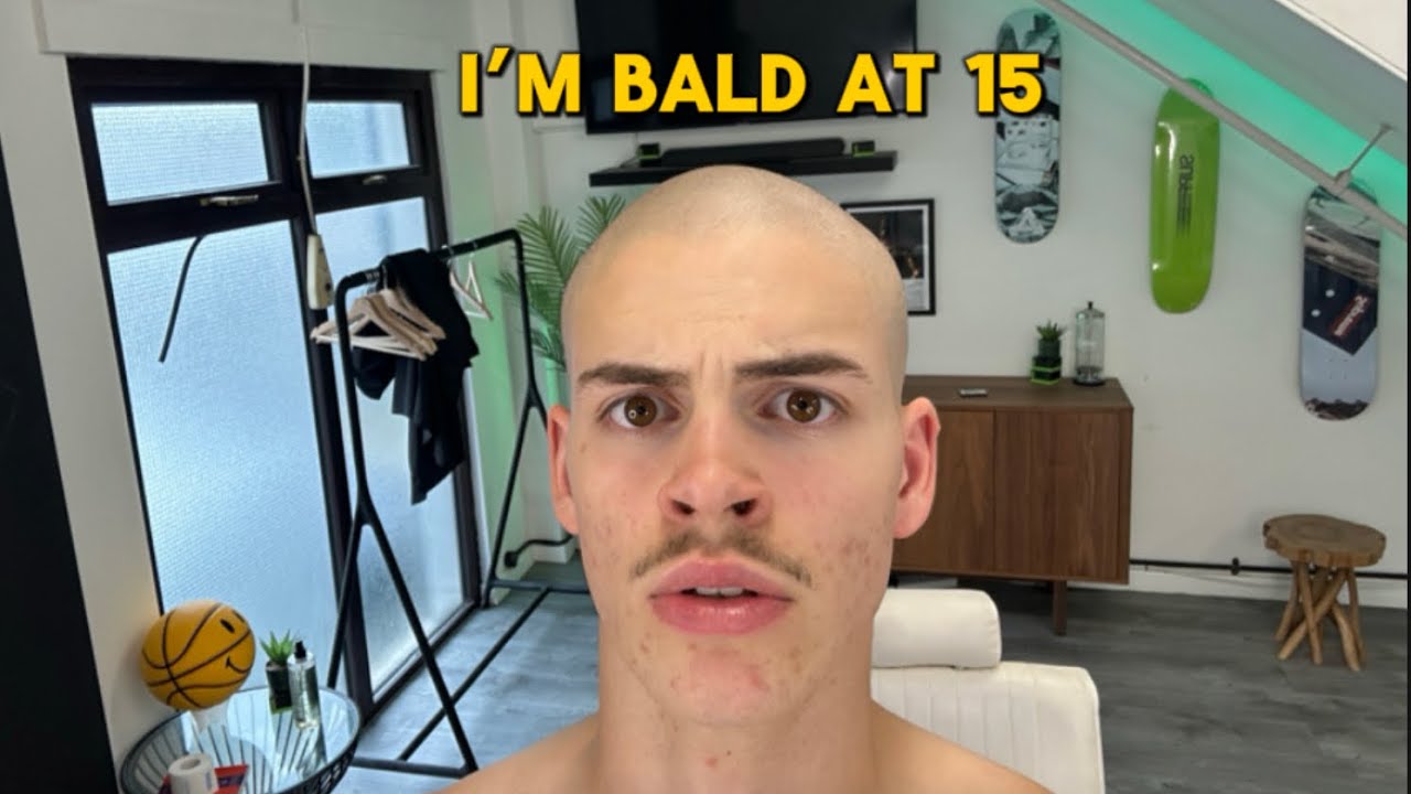 I’m BALD at 15 years old - YouTube