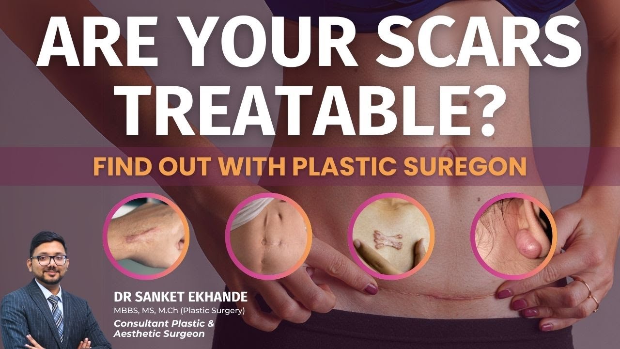 Types Of Scars - Keloid, Scar On Face, Chest Scar, earlobe | Dr. Sanket ...