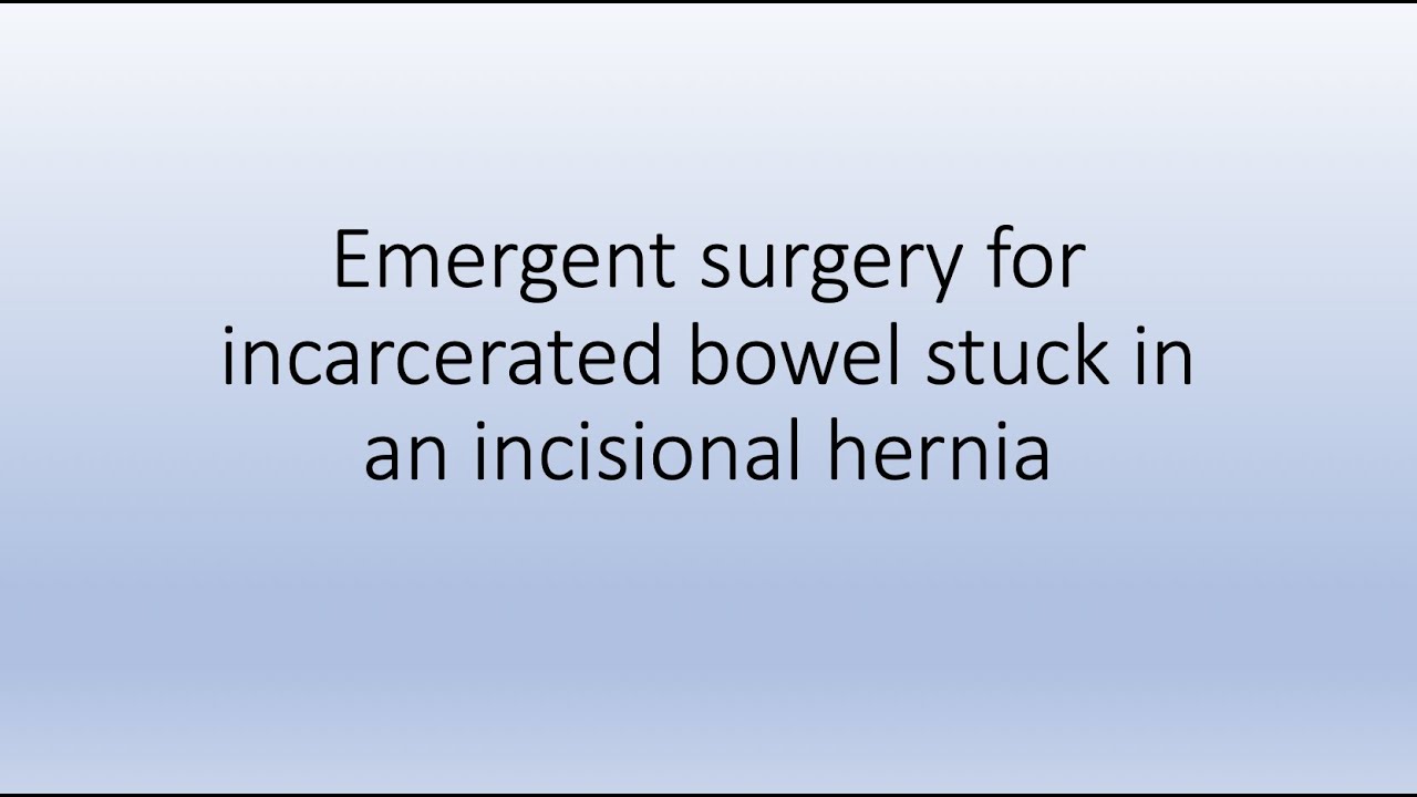 Emergent surgery for incarcerated incisional hernia with strangulated ...