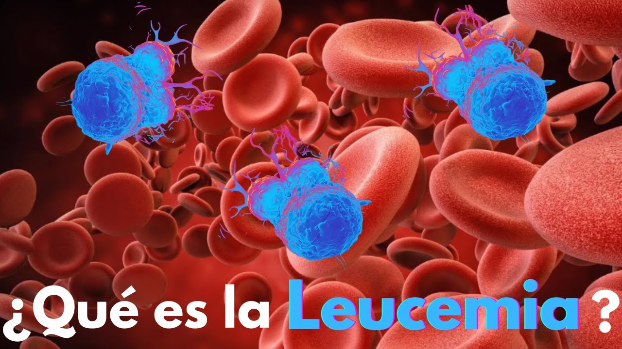 ¿Qué es la Leucemia? - YouTube