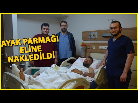 Kopan El Parmağı Yerine Ayak Parmağı Nakledildi