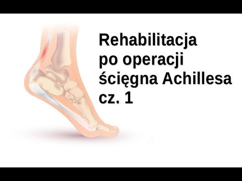Rehabilitacja po operacji ścięgna Achillesa - wskazówki do domu cz. 1 z ...