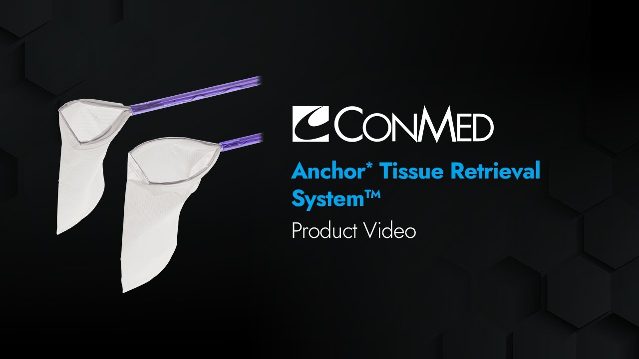Anchor* Tissue Retrieval System™ - CONMED Product Video - YouTube