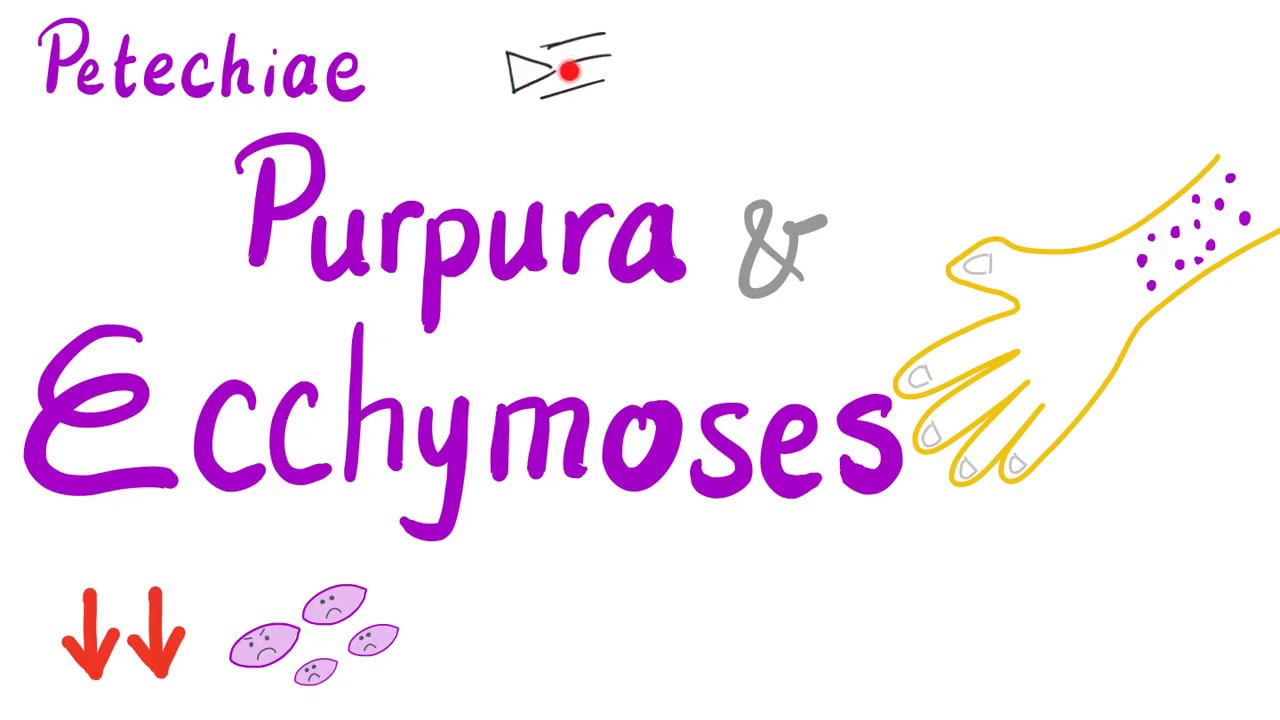 Ecchymosis in Dogs: Decoding Blood Smear Results!