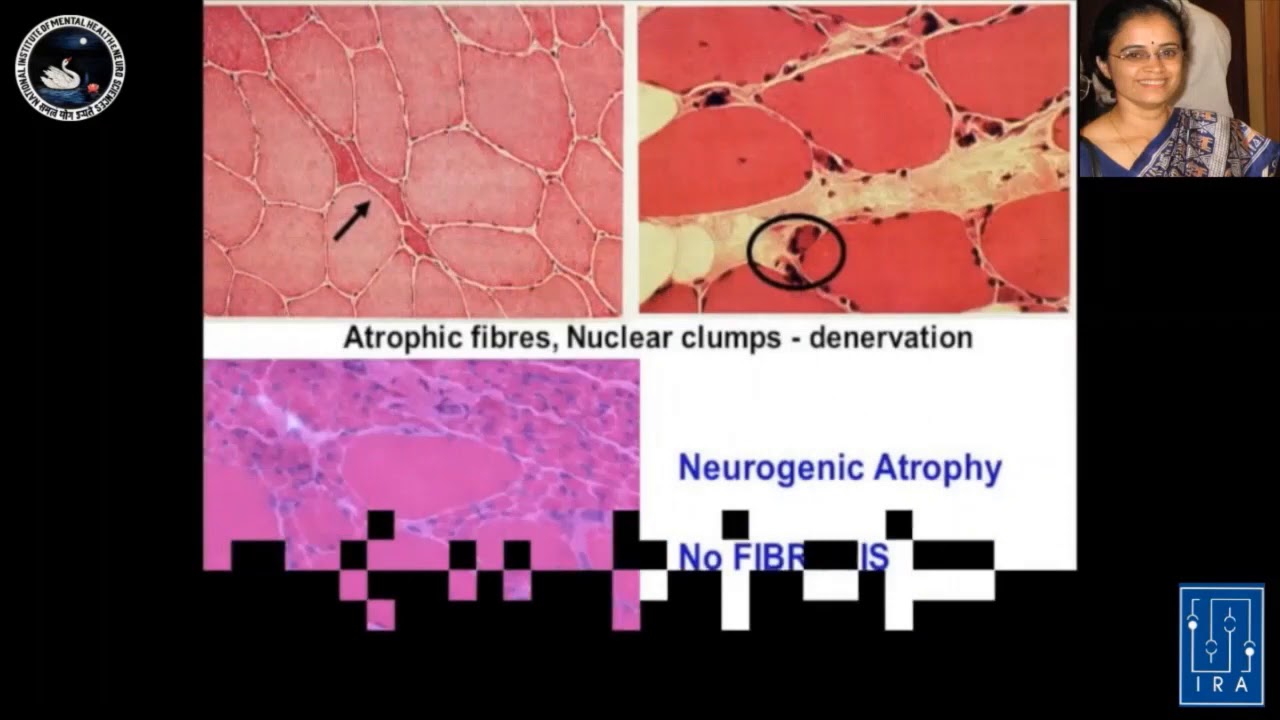 ABC of Muscle Histology - Essentials of Muscle Biopsy Interpretation ...