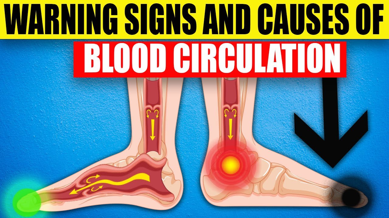 How Poor Blood Circulation Affects Your Body: 10 Warning Signs - YouTube