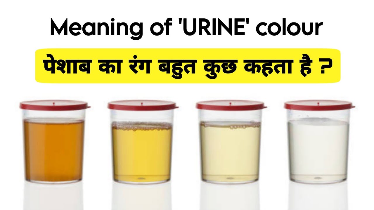 पेशाब के रंग से जाने बीमारी | peshab ke rang se jane bimari | Urine ...