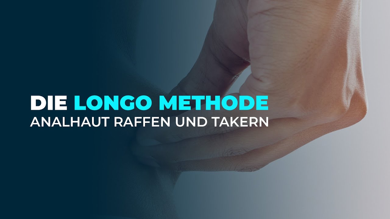 SCHMERZSYNDROM nach LONGO OP! Dr. Eduard Karsten klärt auf - YouTube