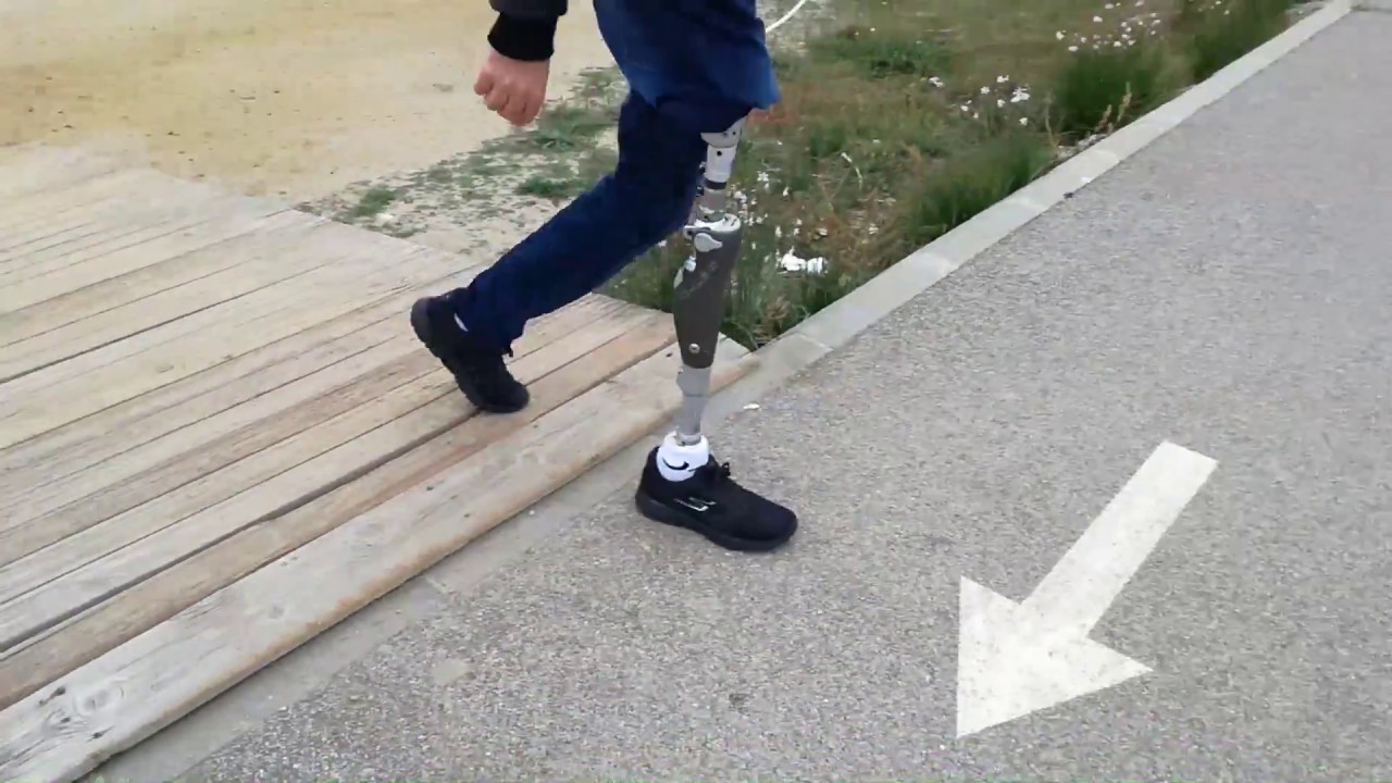 Prótesis Amputee C-leg vs 3R80 - YouTube