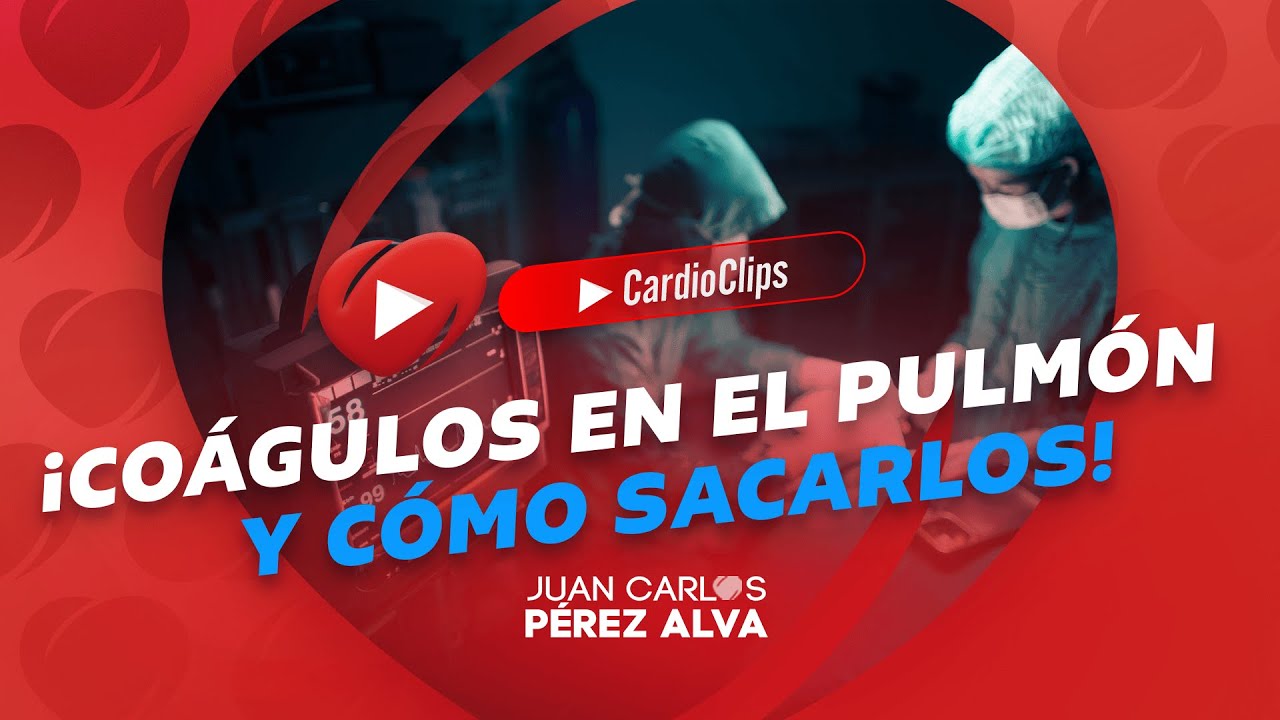 COÁGULOS EN EL PULMÓN Y CÓMO SACARLOS - YouTube