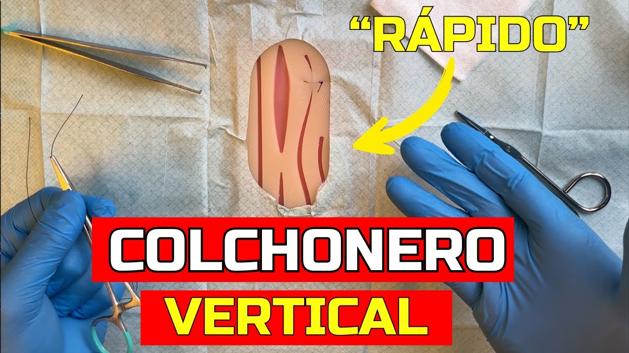 Descubre Cómo PONER un PUNTO COLCHONERO VERTICAL Fácil y Rápido - YouTube