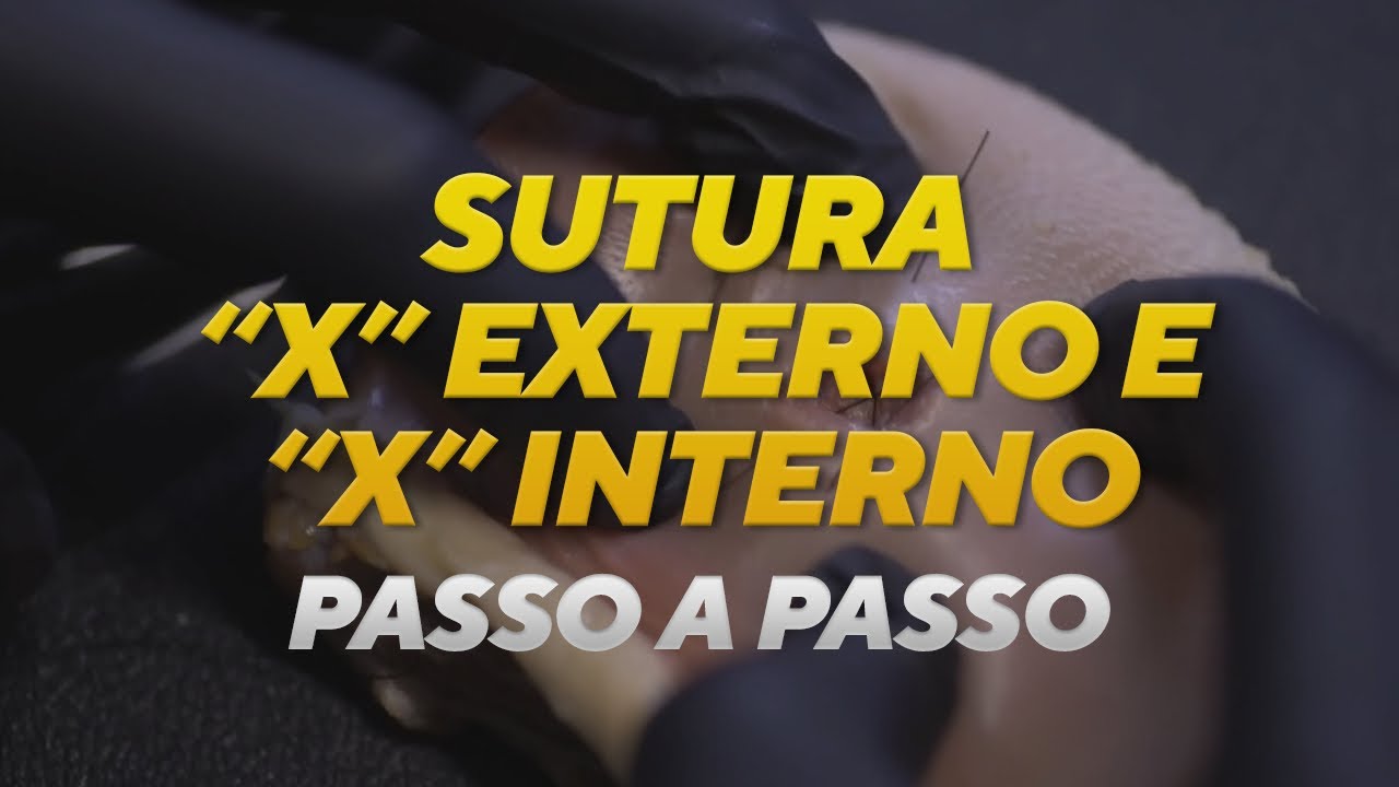 Sutura “X” externo e “X” interno. Passo a passo! - YouTube