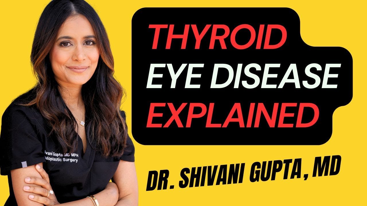 Thyroid Eye EXPERT Shares Revolutionary Treatment | Thyroid Bulging ...