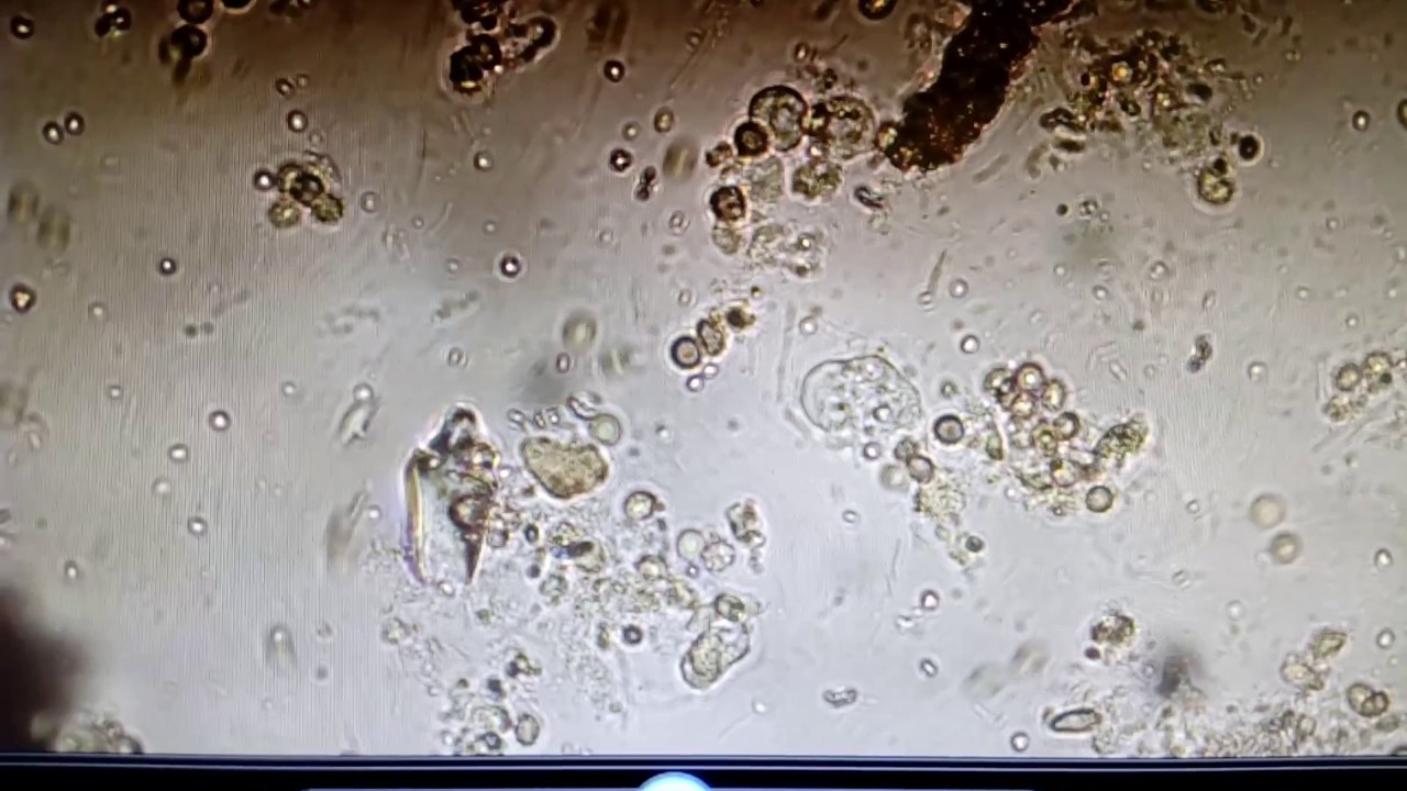 Trophozoite of Entamoeba histolytica - YouTube
