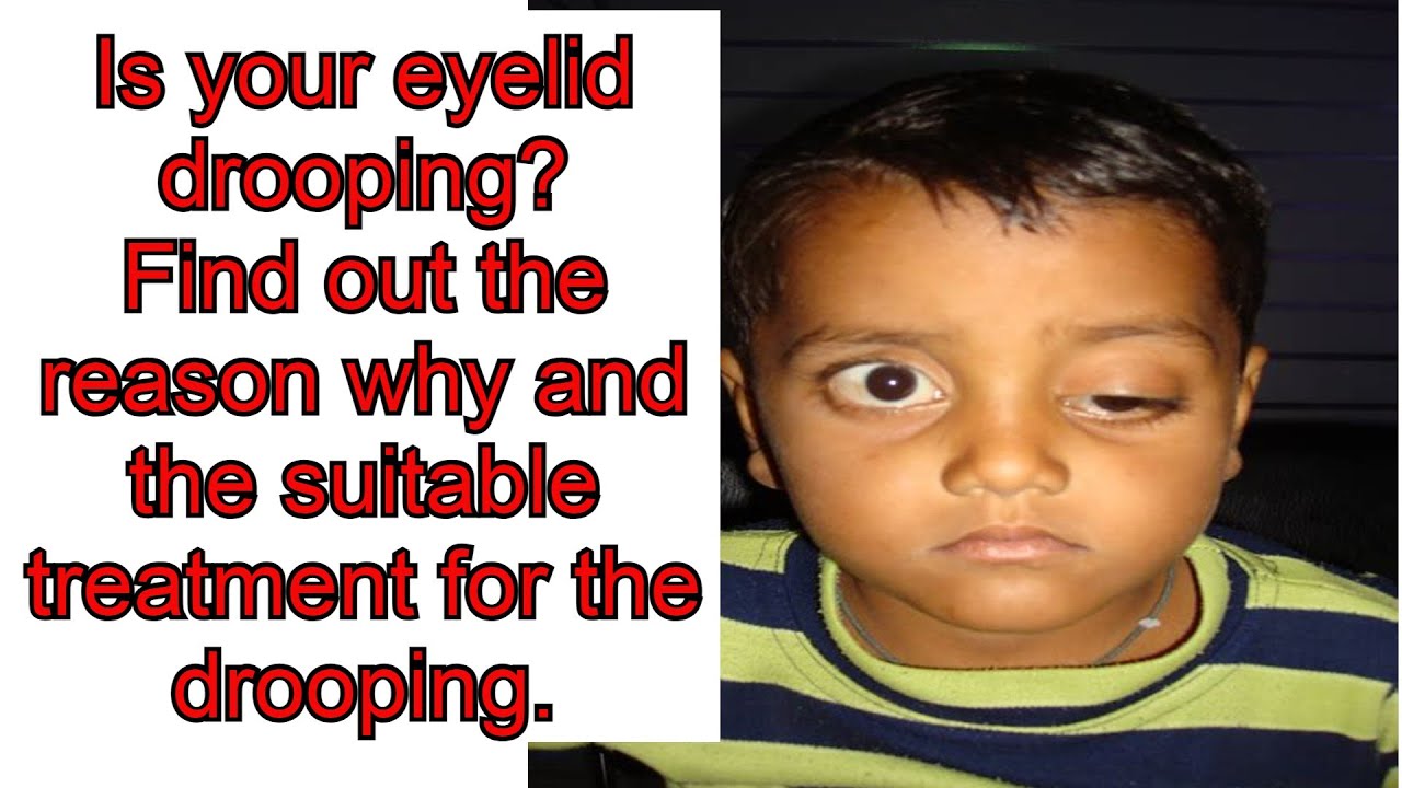 Find out the reason why and the suitable treatment for the eye drooping ...