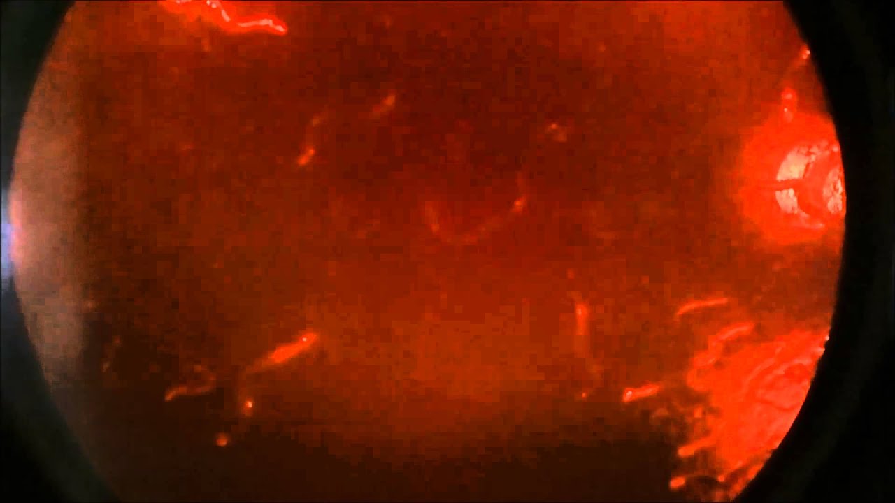 worms from hell - YouTube