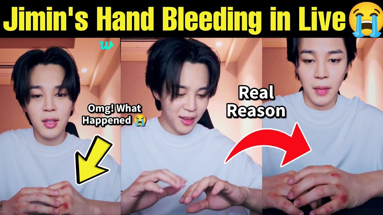 Jimin's Hand Bleeding in Live 🔴 Omg! What Happened To Jimin 😭 #bts # ...