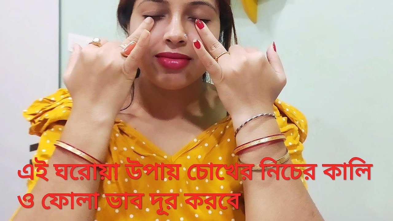 Chokher niche kalo dag dur hobe /How to reduce darkcircle of eyes ...