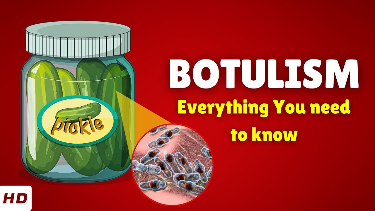 Botulism – Causes, Types, Signs and Symptoms, Diagnosis & Treatment ...