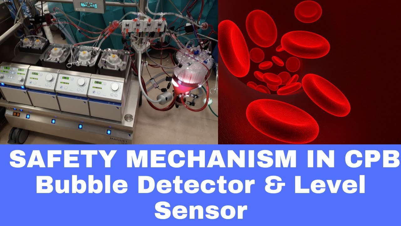 Safety Mechanism in CPB ( Level sensor & Bubble Detector) - YouTube