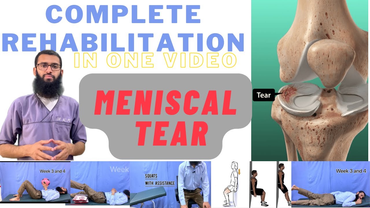 Meniscus Tear Exercises Without Surgery | Meniscus Tear Recovery | How ...