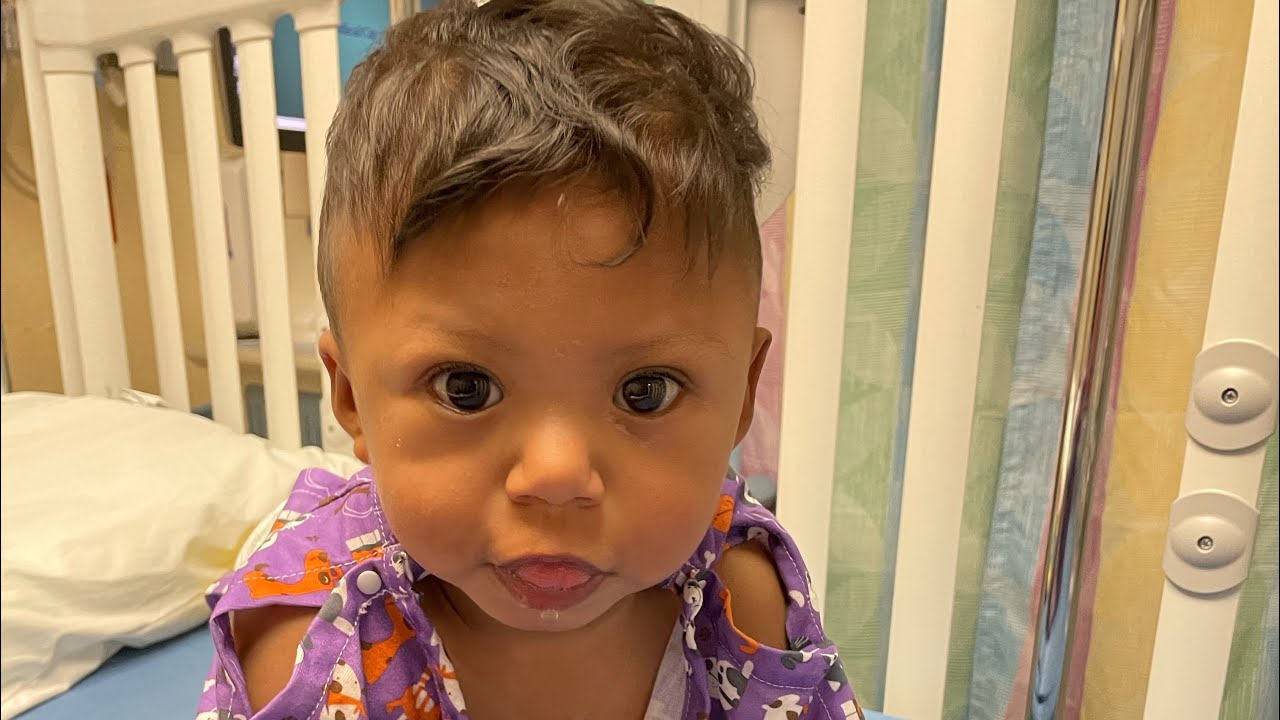 Macroglosia( Moroni entro a cirugía para reducirle el tamaño de su ...