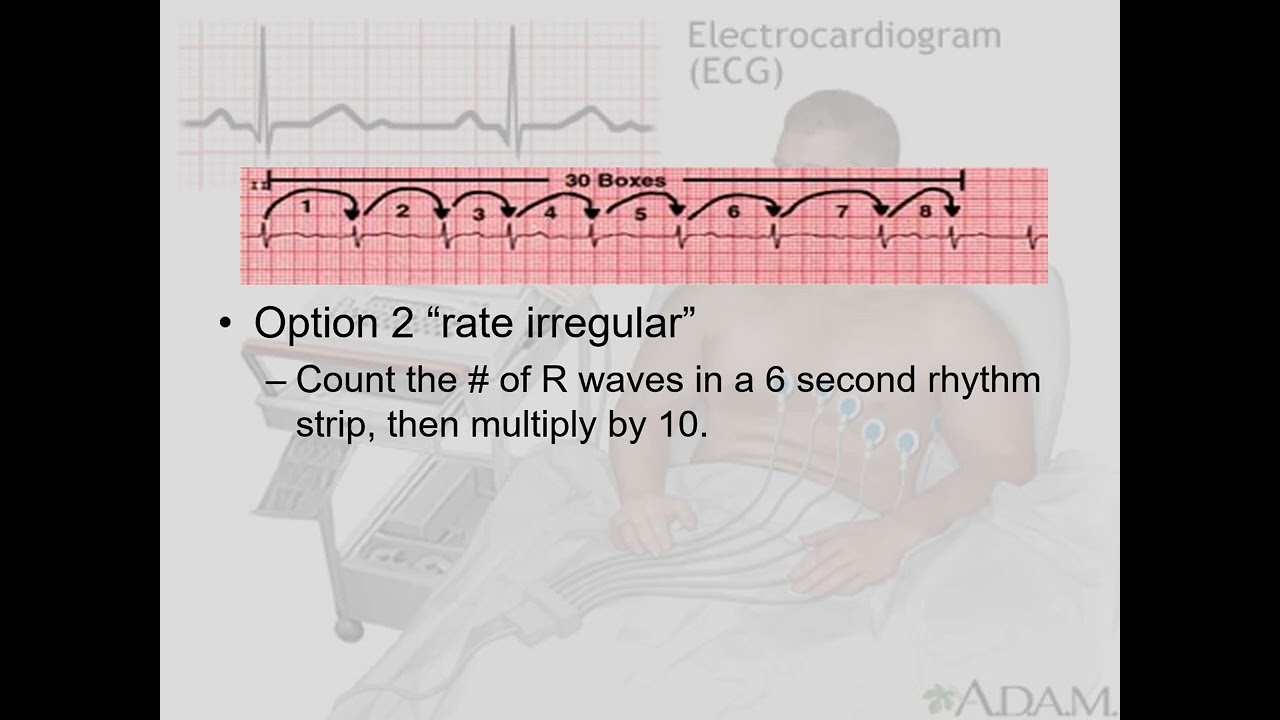 ecg lecture one part 3 scheme for reading ECG - YouTube
