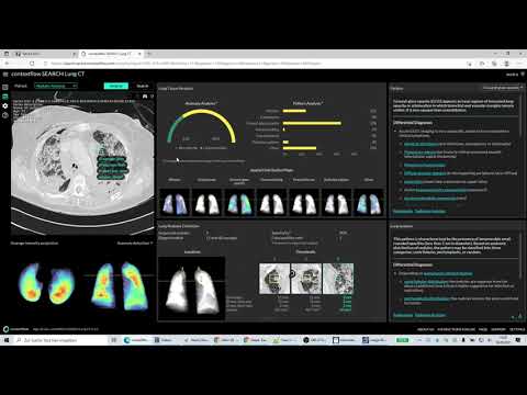 Sectra IDS7 CFS Integration - YouTube
