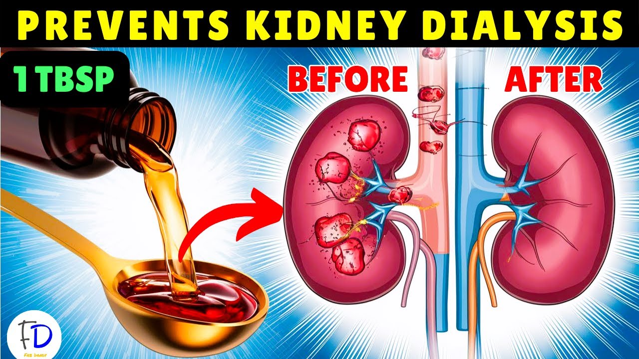 No KIDNEY Patients Will Ever Lose Another Kidney - YouTube