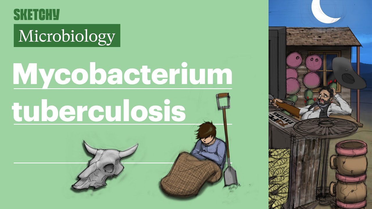 Mycobacterium Tuberculosis (Microbiology) | USMLE Step 1 | Sketchy ...