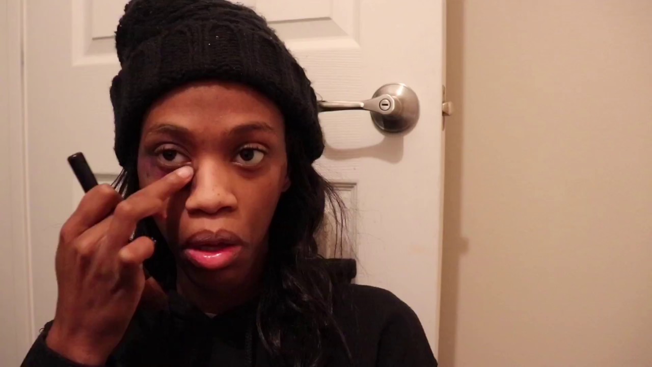 I got beat up prank - YouTube