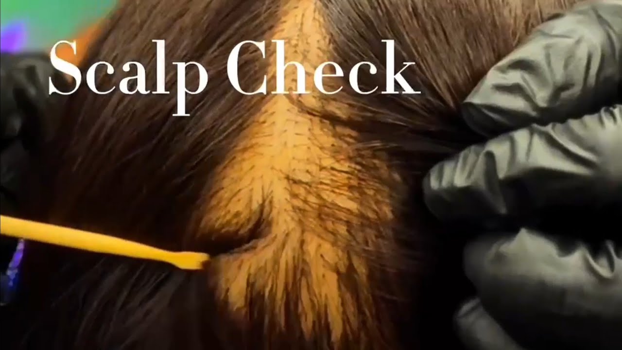 Ultimate Relaxation: Tingly Scalp Check For Deep Sleep | Asmr, No ...