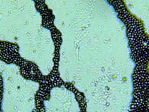 Un peu de levure au microscope - YouTube