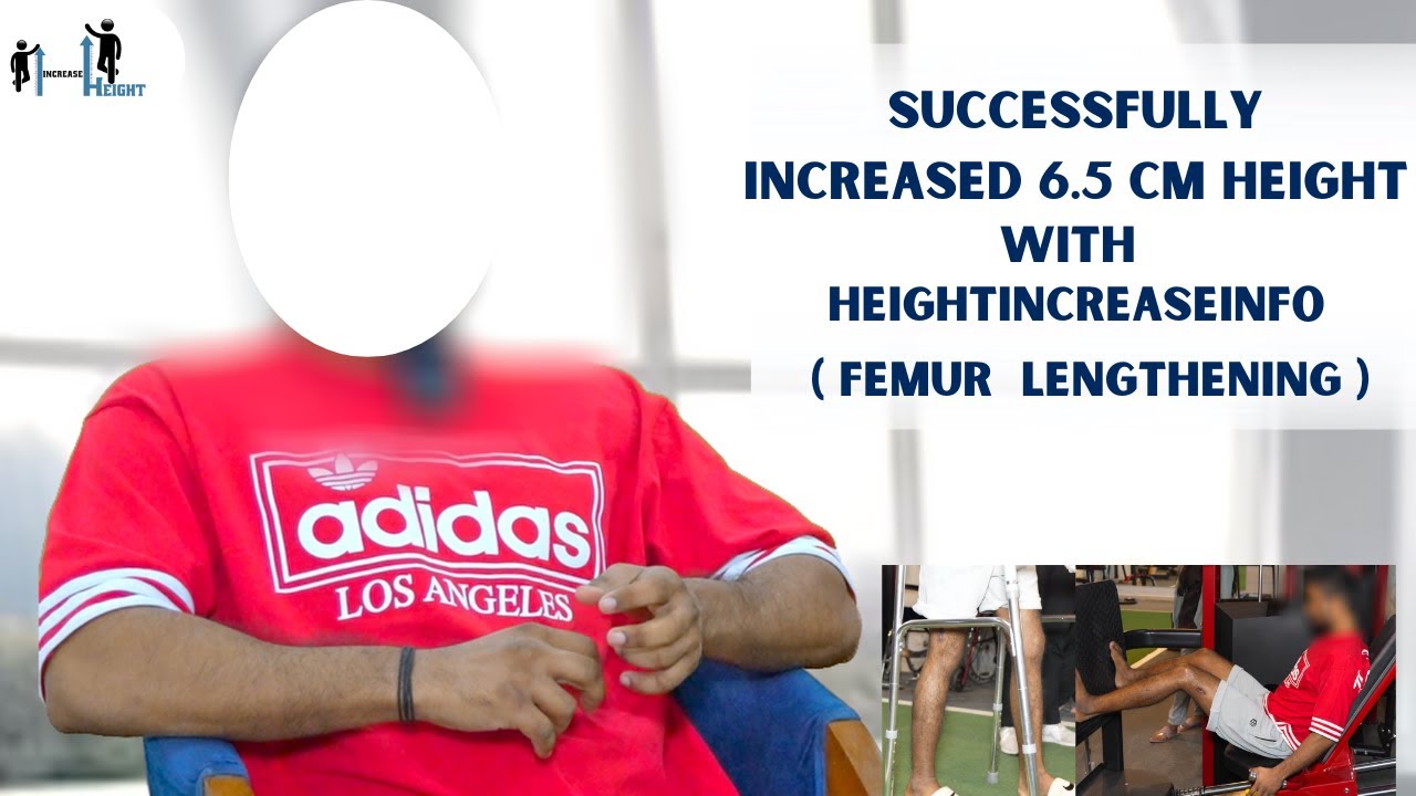 successfully-increased-6-5-cm-height-with-heightincreaseinfo-femur