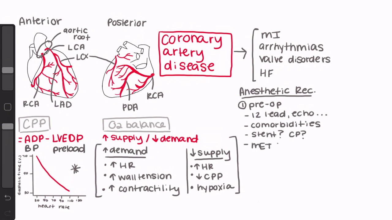 Anesthesia Implications for Coronary Artery Disease - YouTube